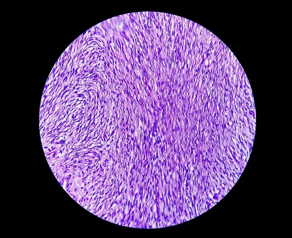 Do You Know What an Acoustic Microscope Is? Listen Up!